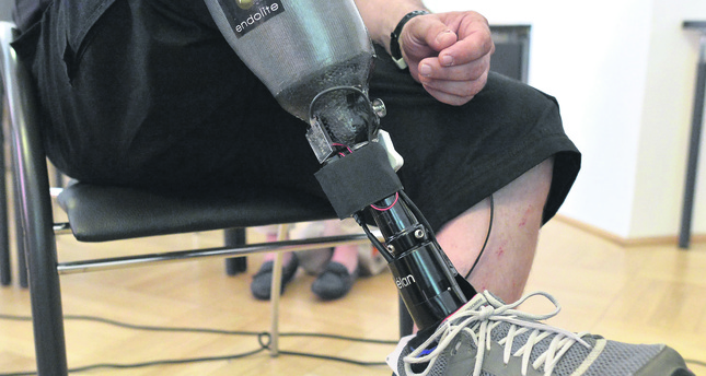World's first ‘feeling' prosthetic leg offers new hope to amputees ...