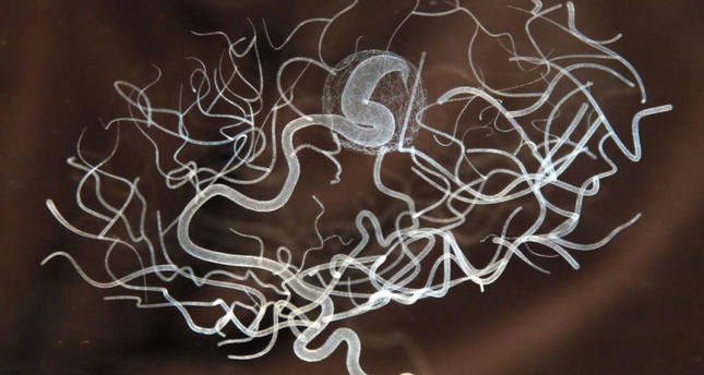 Total recall: brain process for memory formation revealed - Daily Sabah