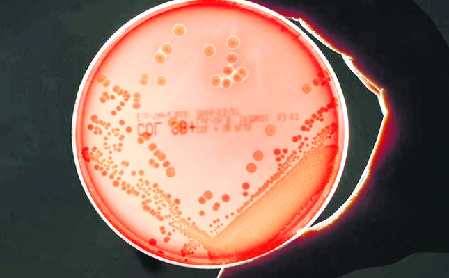 Canadian scientists warn of new superbug bacteria - Daily Sabah