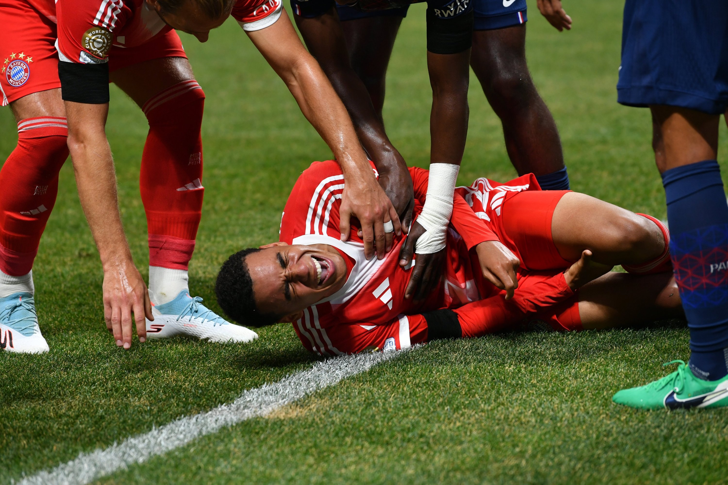 Musiala dismisses blame game following Club World Cup leg injury ...